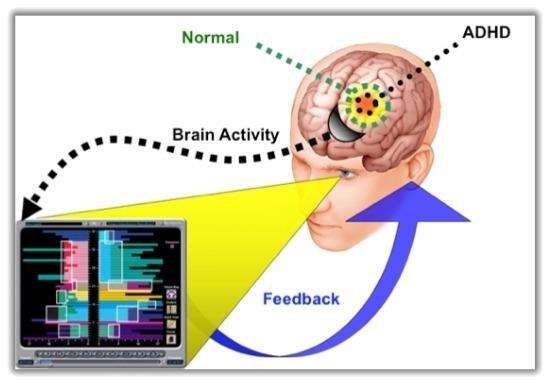 Retirement - Brain Gain
